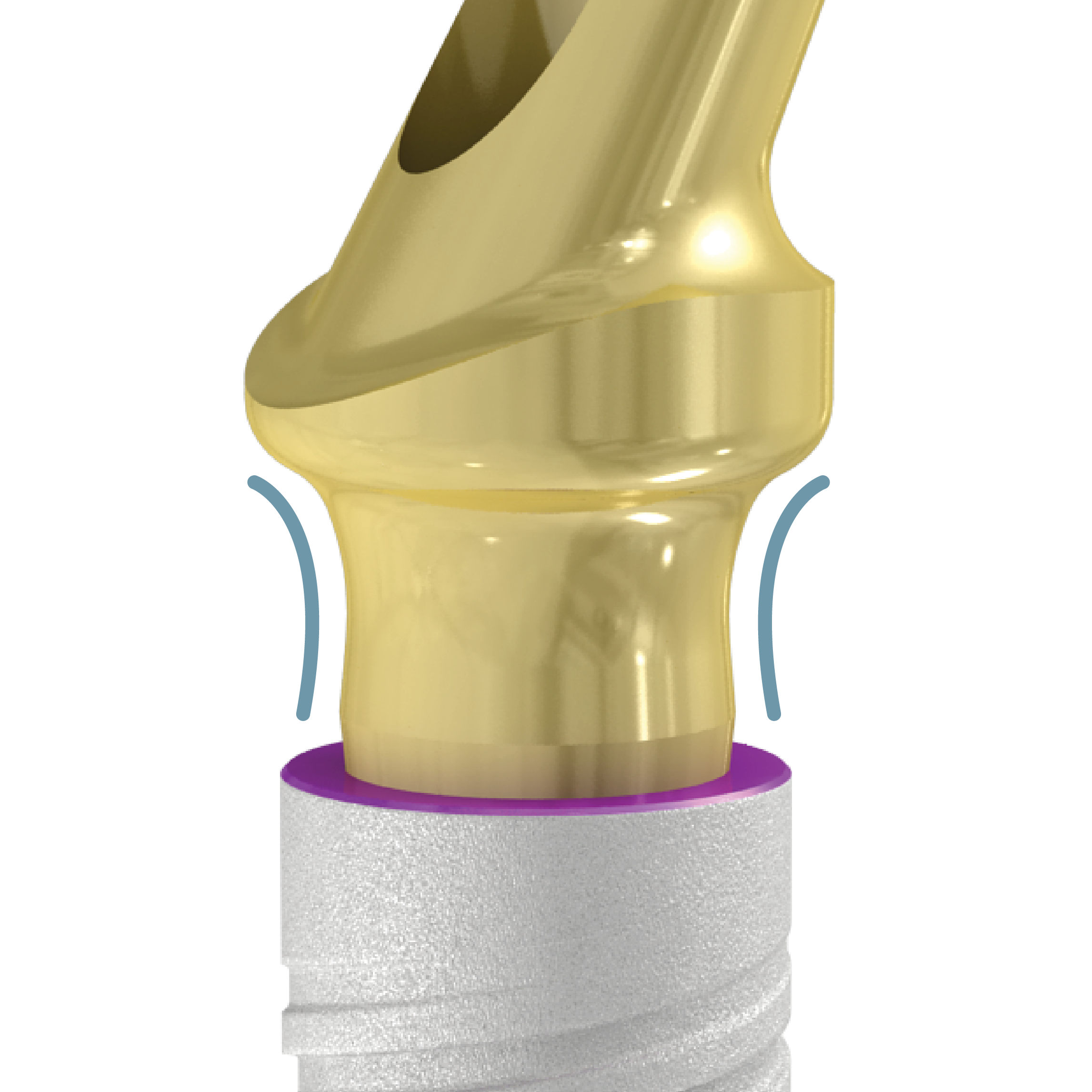 MIS Implants | Lance+
